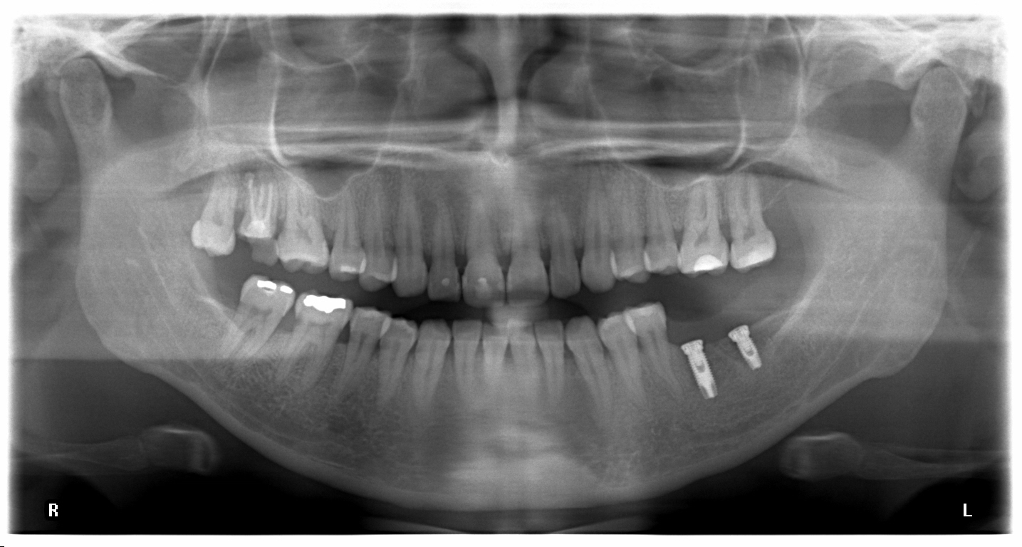 Dental X- Rays, Cephalometric, CBCT - Teledentistry
